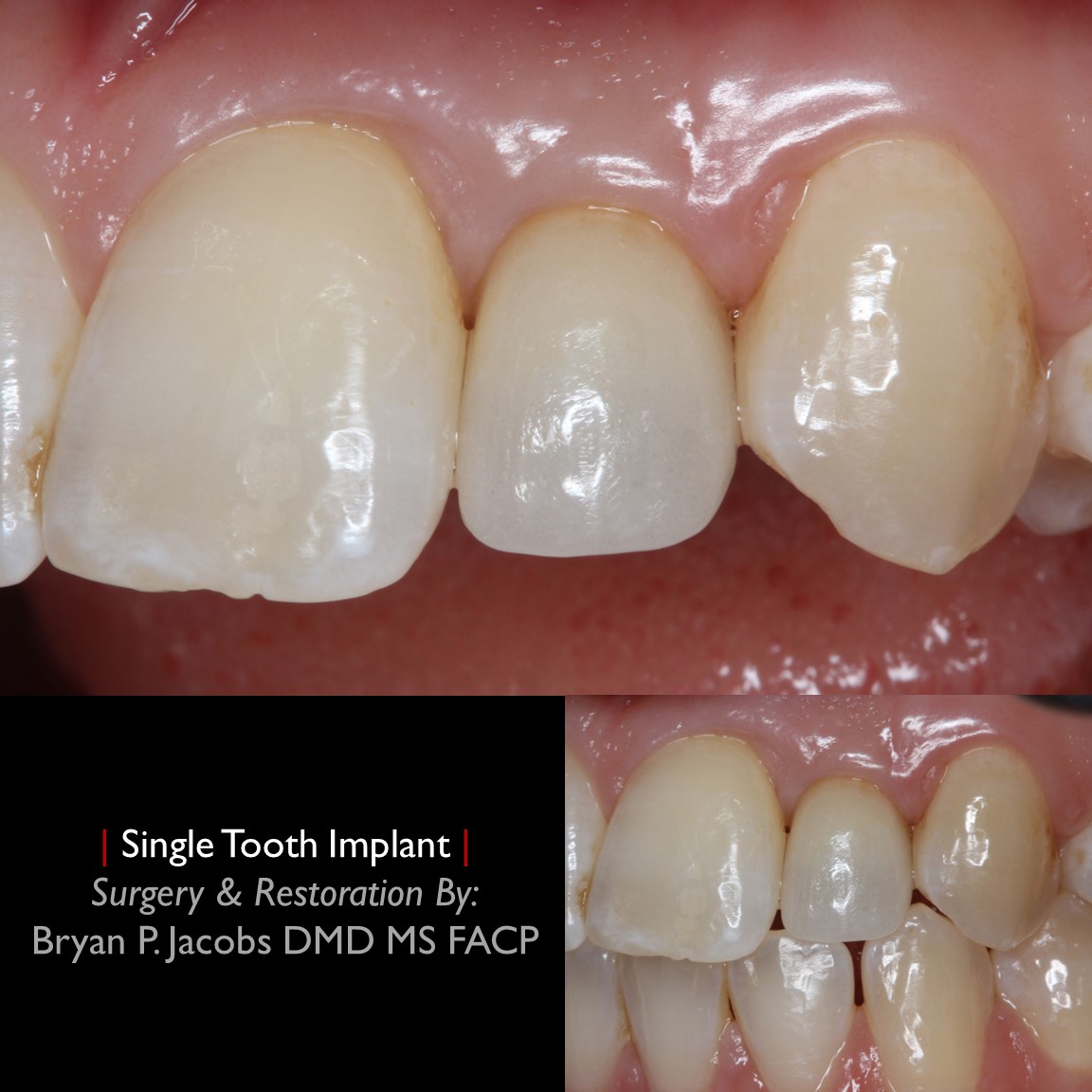 Before & After Smile Gallery | Dental Professionals
